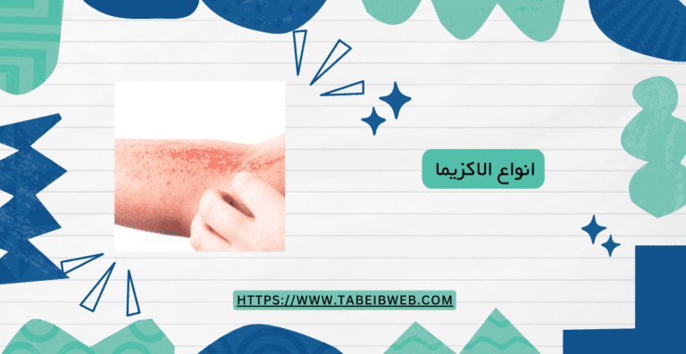 انواع الاكزيما بالصور - طبيب ويب